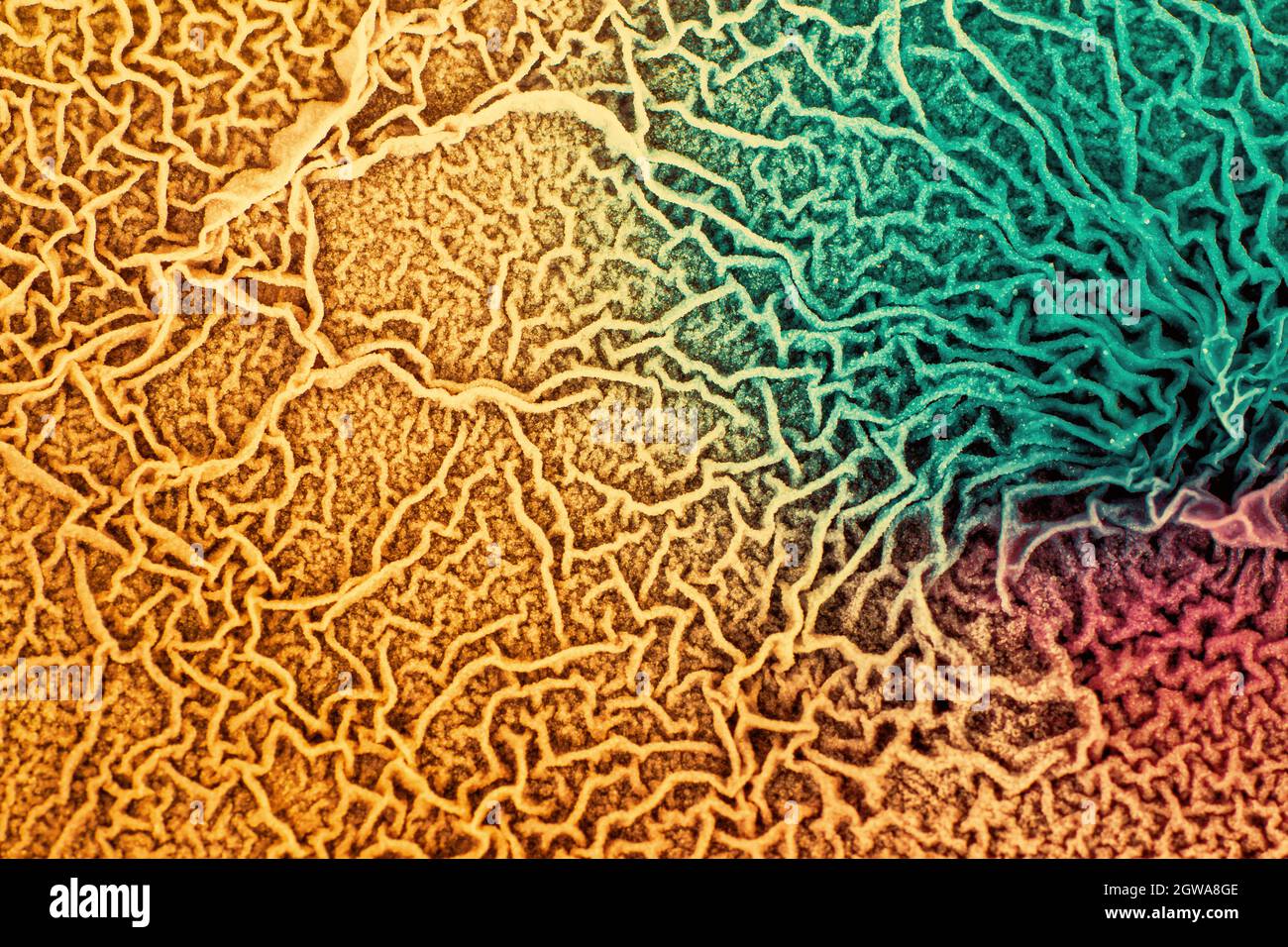 Scanning electron microscope image hi-res stock photography and images ...