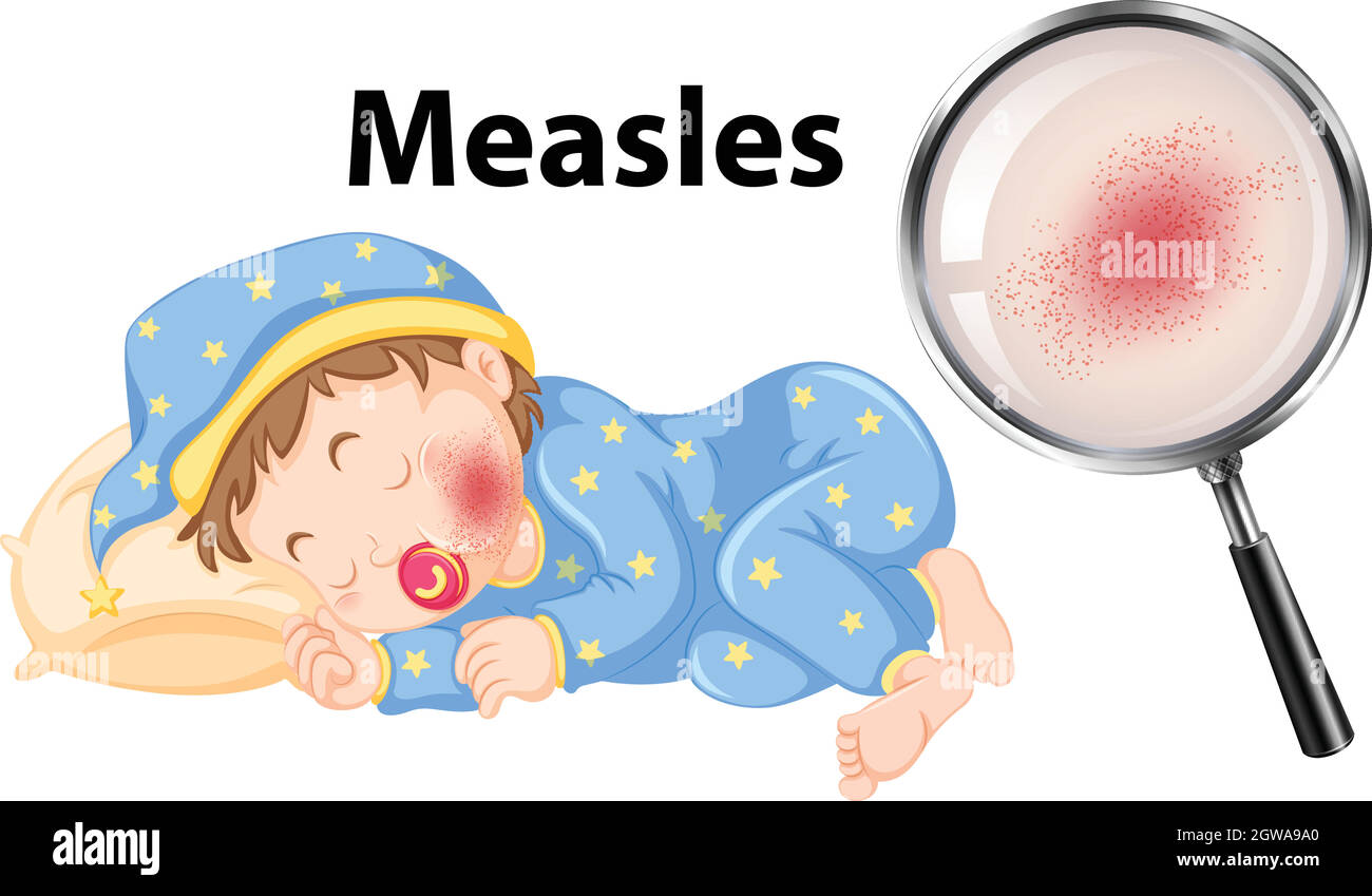 Baby fever Stock Vector Images - Alamy