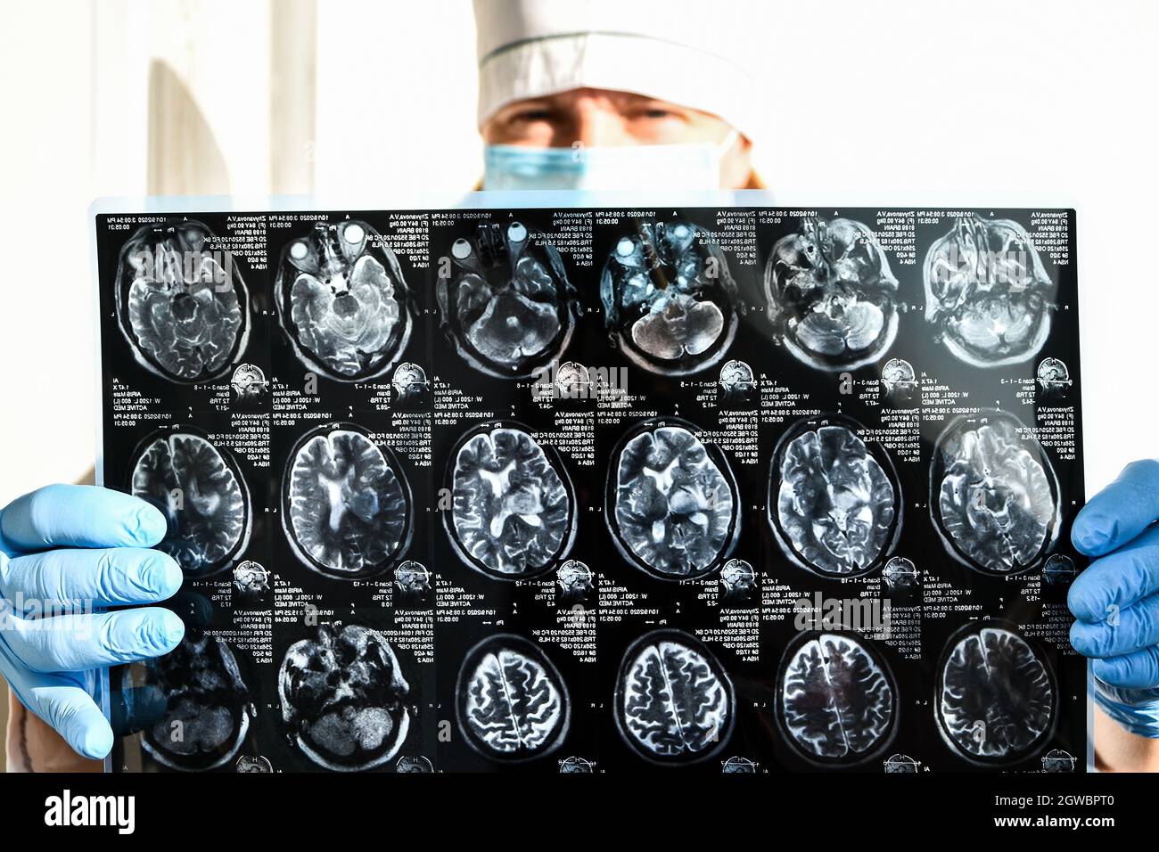 Hand holding human brain in hi-res stock photography and images - Alamy