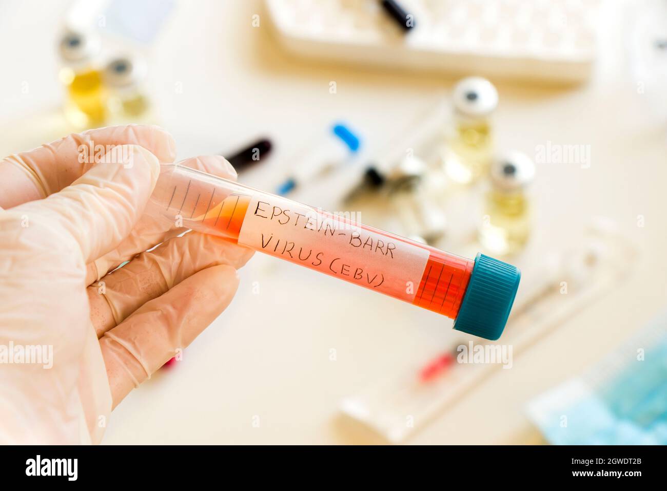 Infectious Mononucleosis High Resolution Stock Photography and Images ...