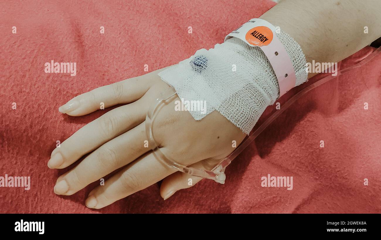 Shattered leg hi-res stock photography and images - Alamy