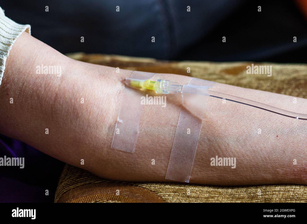Vitamin drip iv hi-res stock photography and images - Alamy Vitamin drip iv hi-res stock photography and images - Alamy
