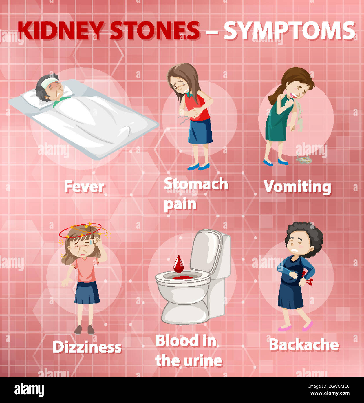 Kidney Stones In Toilet