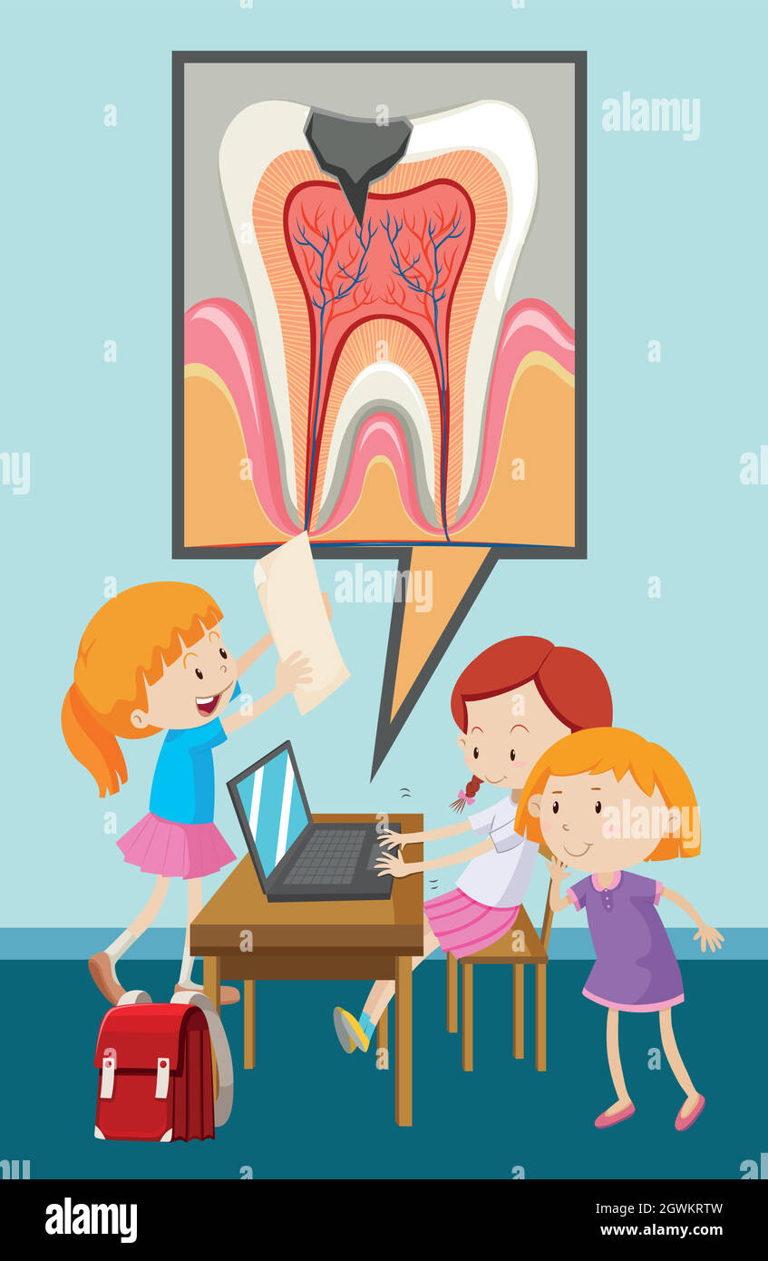 Tooth diagram clipart hi-res stock photography and images - Alamy