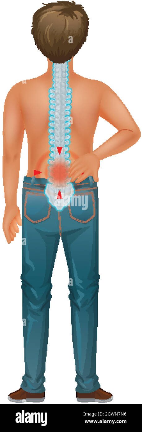 Back pain in human on white background Stock Vector Image & Art - Alamy
