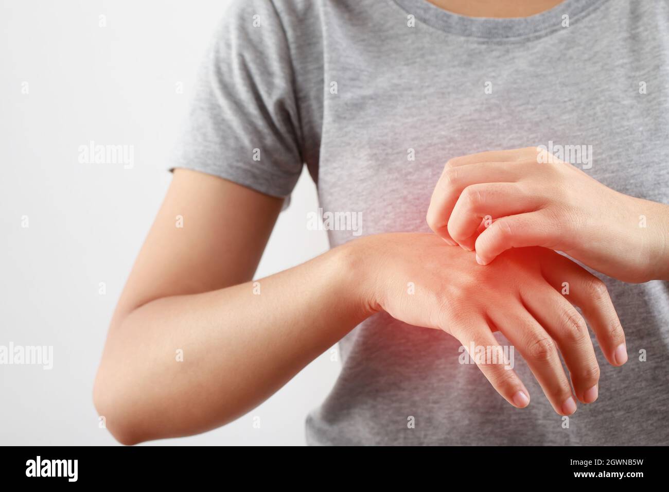 Itchy skin hi-res stock photography and images - Alamy