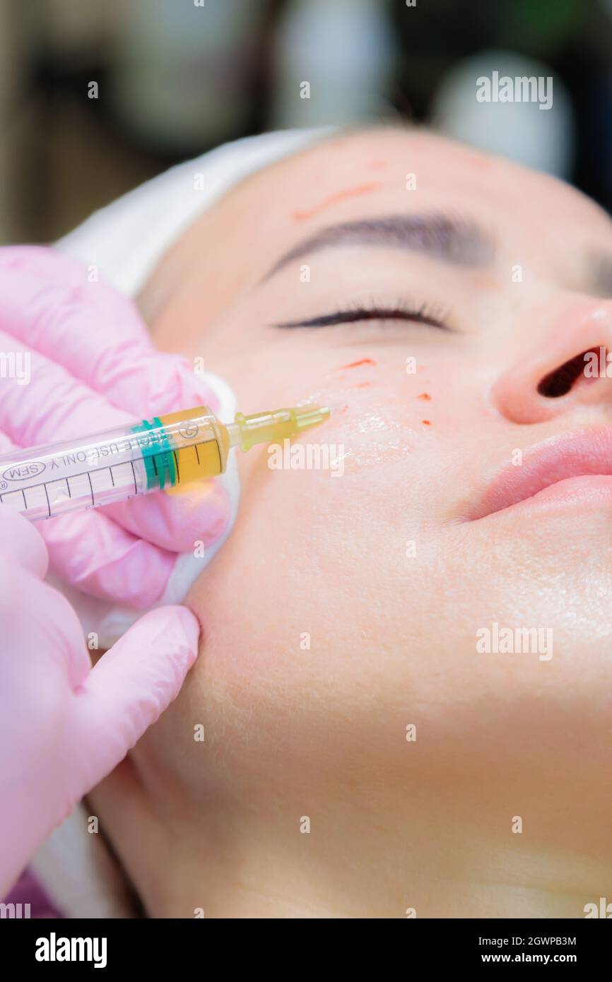 The Doctor Gives Injections Of Blood Plasma Into The Face Of A Young ...