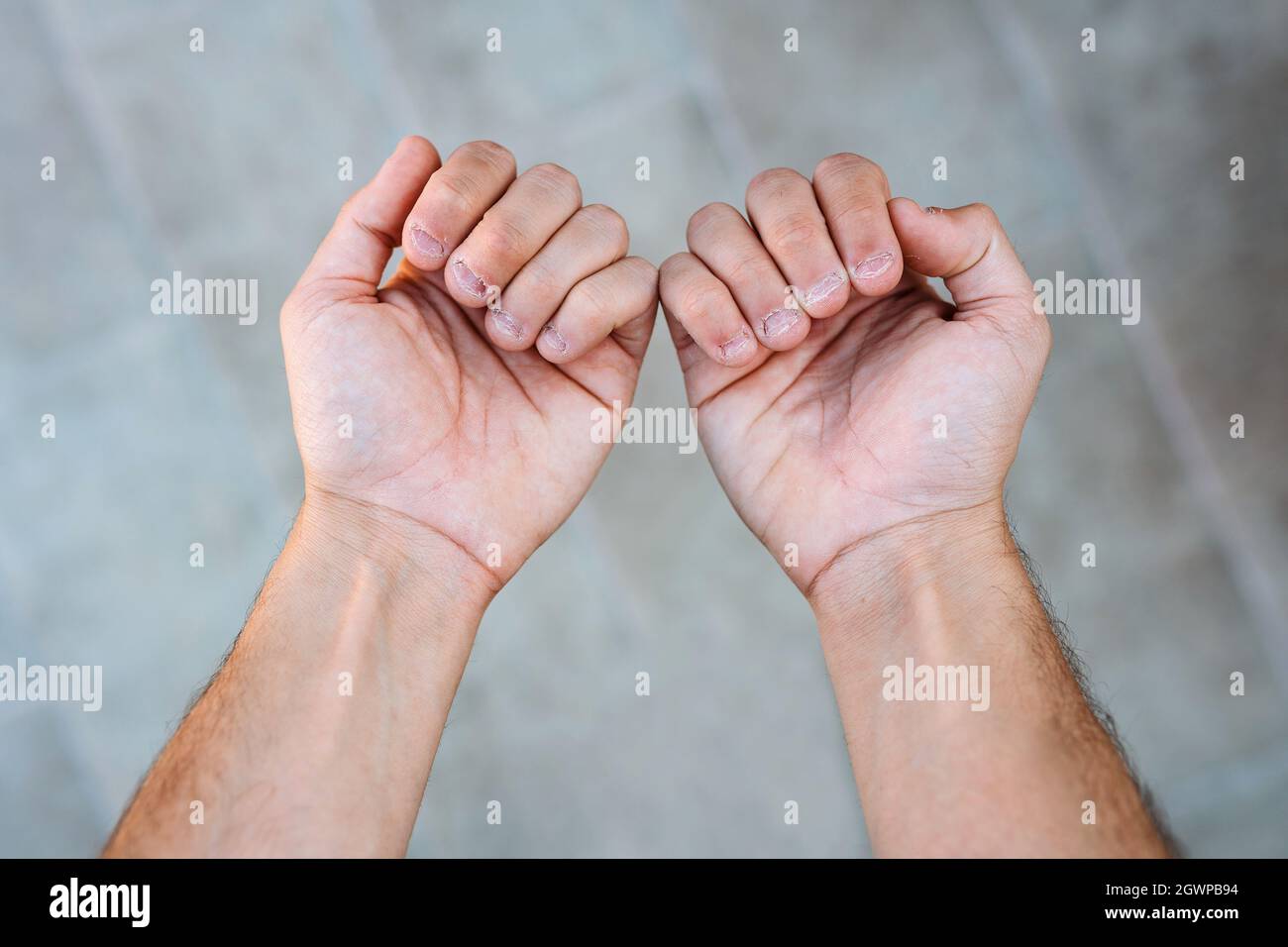 Chewing fingernails hi-res stock photography and images - Alamy