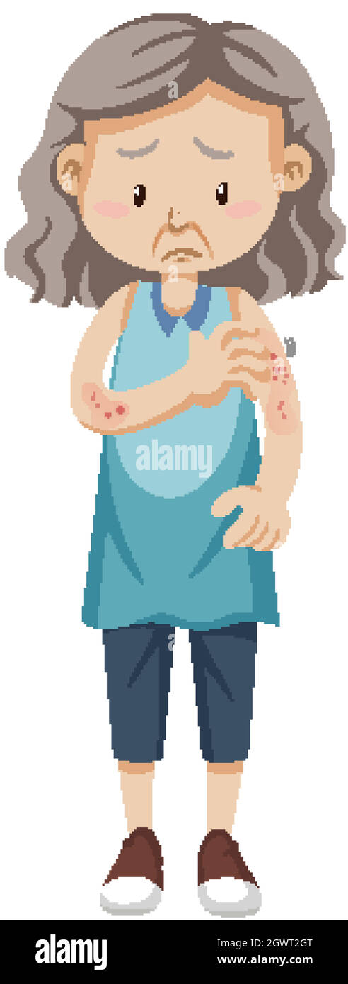 Skin rash hi-res stock photography and images - Alamy