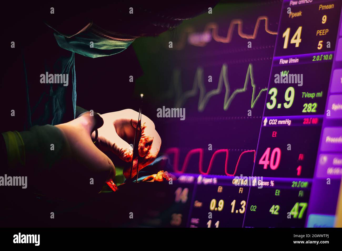 Ekg Machine High Resolution Stock Photography and Images - Alamy