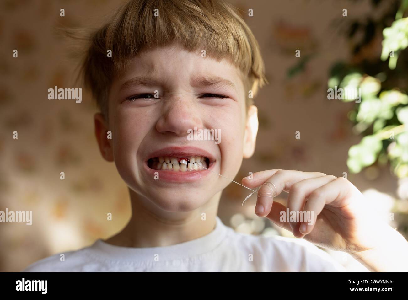 Ginger boy wearing white T-shirt is pulling his tooth with help of ...
