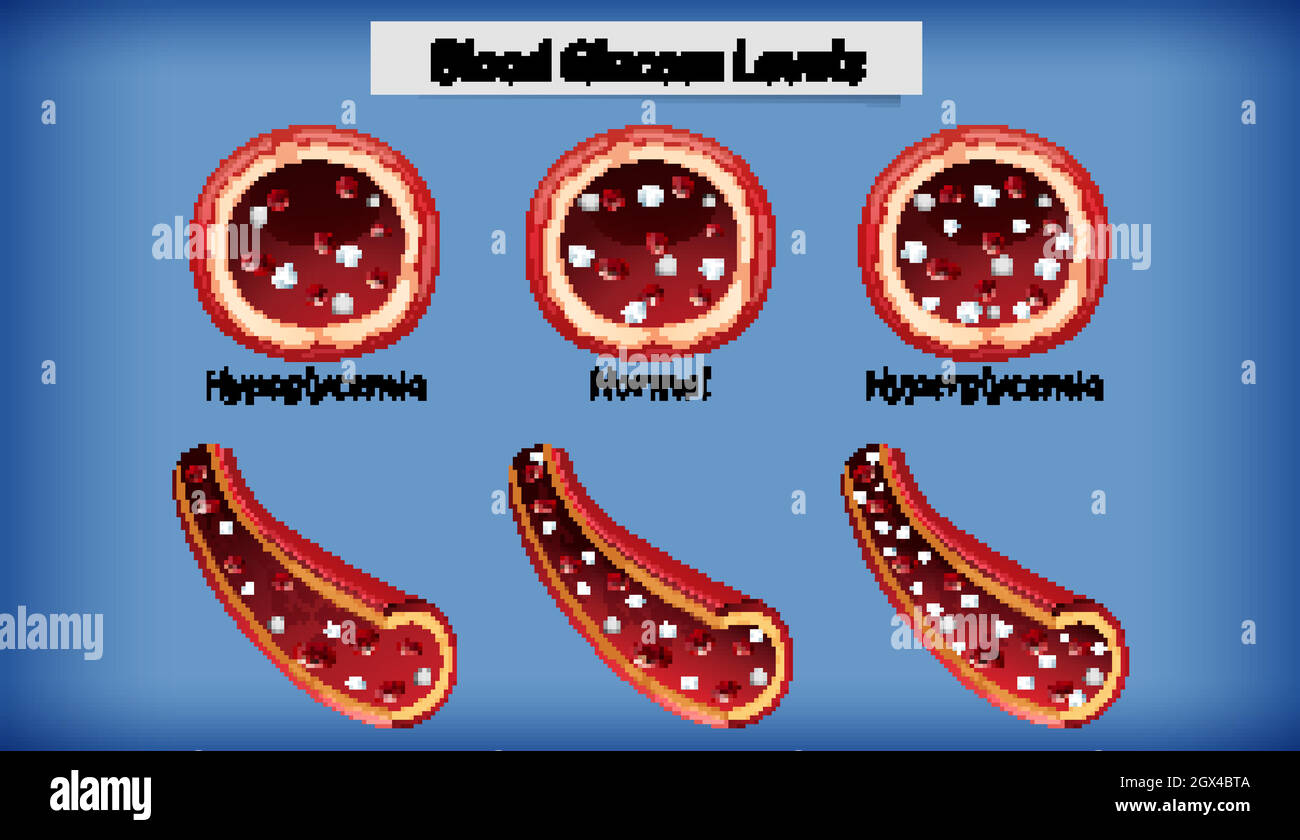 Medical blood glucose level Stock Vector Image & Art - Alamy