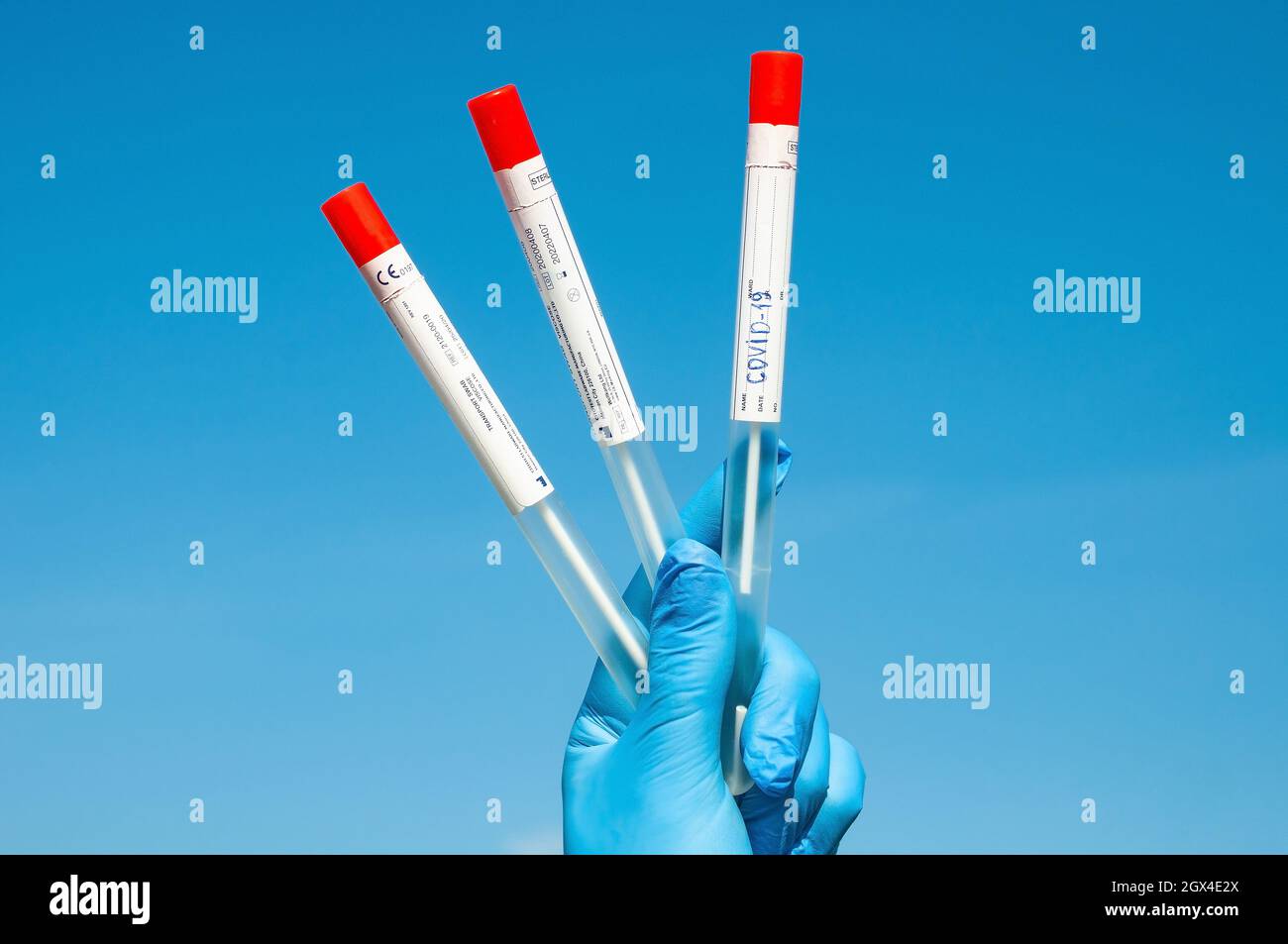 Biochemical tests bacteria hi-res stock photography and images - Alamy