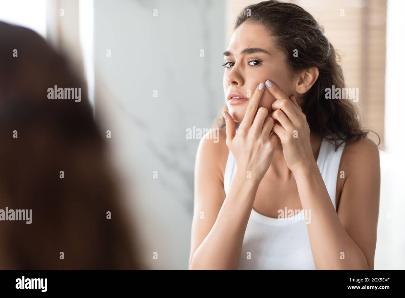 Squeeze pimples hi-res stock photography and images - Alamy