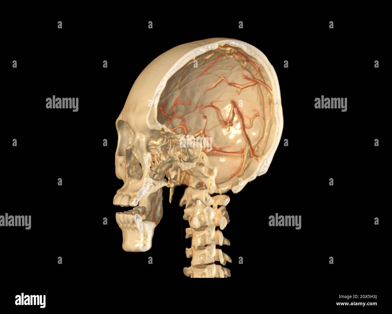 Ct scan showing cross section human hi-res stock photography and images ...