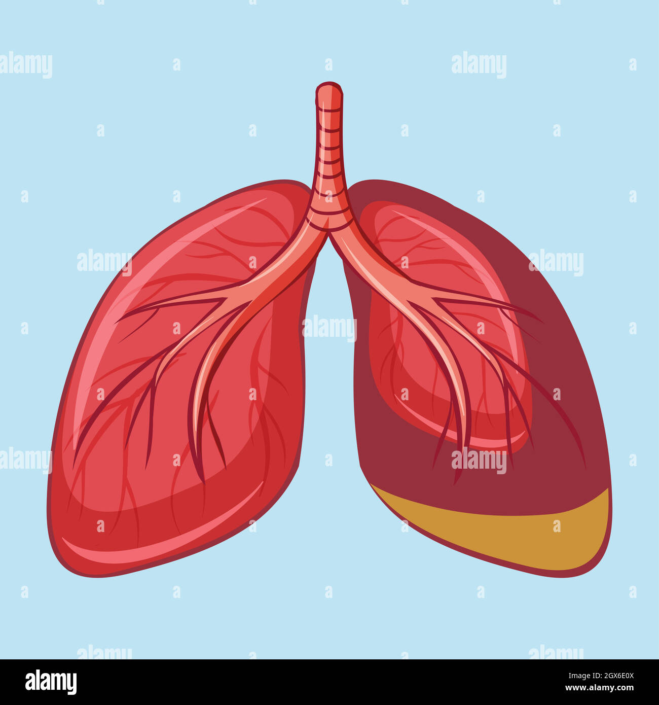 Pleural cancer hi-res stock photography and images - Alamy