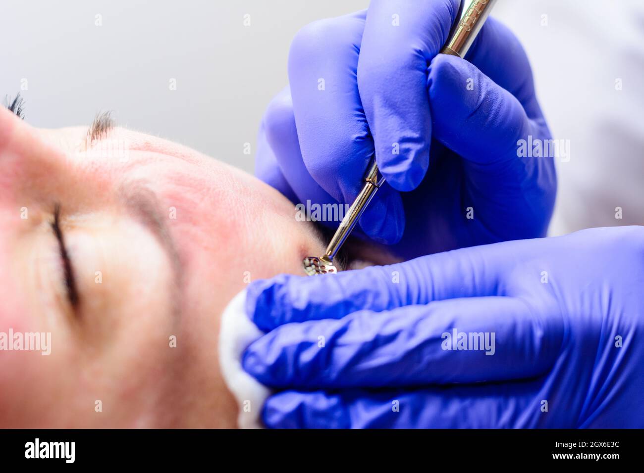 Mechanical facial cleansing, skin cleansing procedure from surface and ...