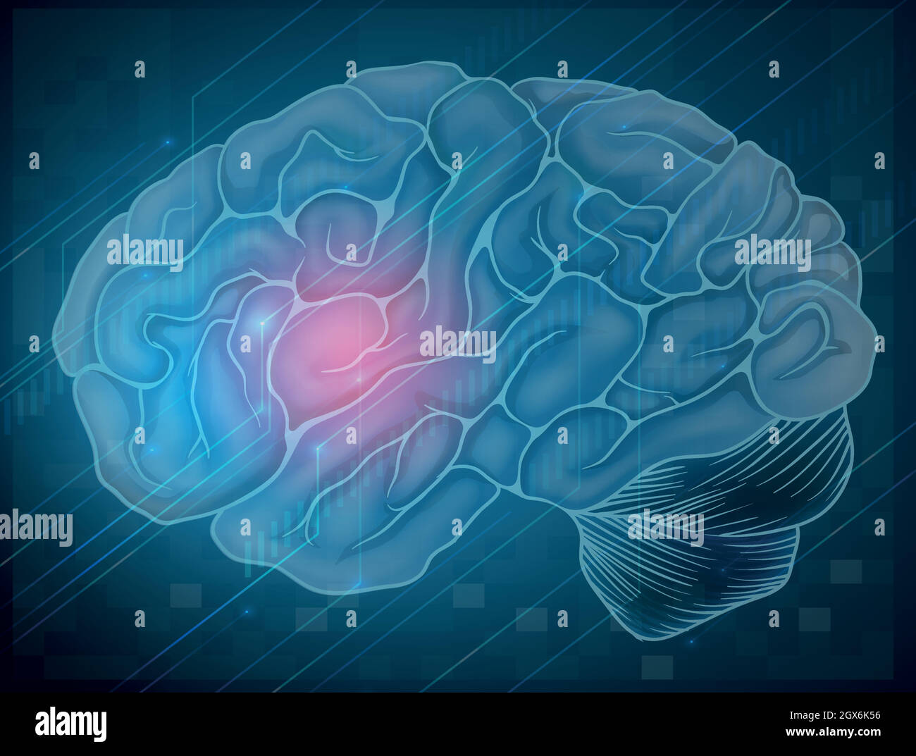 Brain with pain Stock Vector Image & Art - Alamy