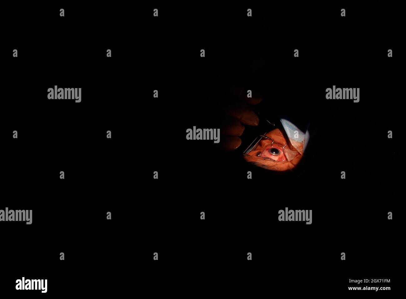 Kathmandu, Nepal. 4th Oct, 2021. Doctor Sanduk Ruit performs a cataract ...