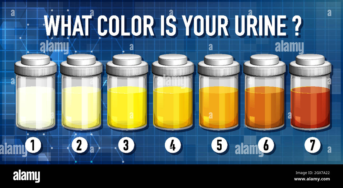 Illustration of urine color chart Stock Vector Image & Art - Alamy