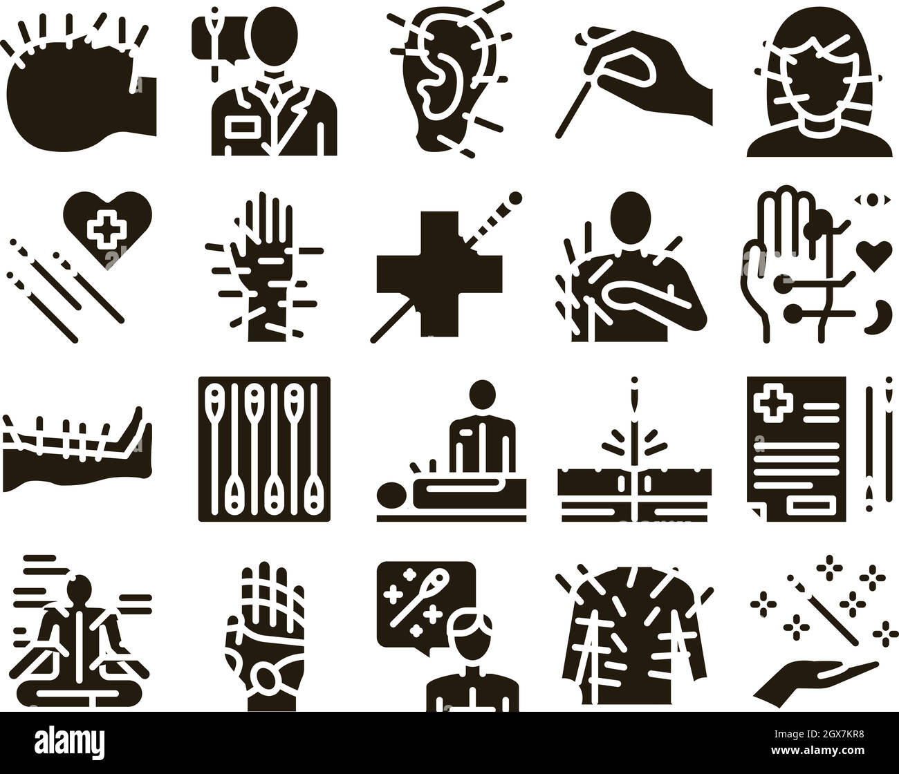 Acupuncture needles treatment body Stock Vector Images - Alamy