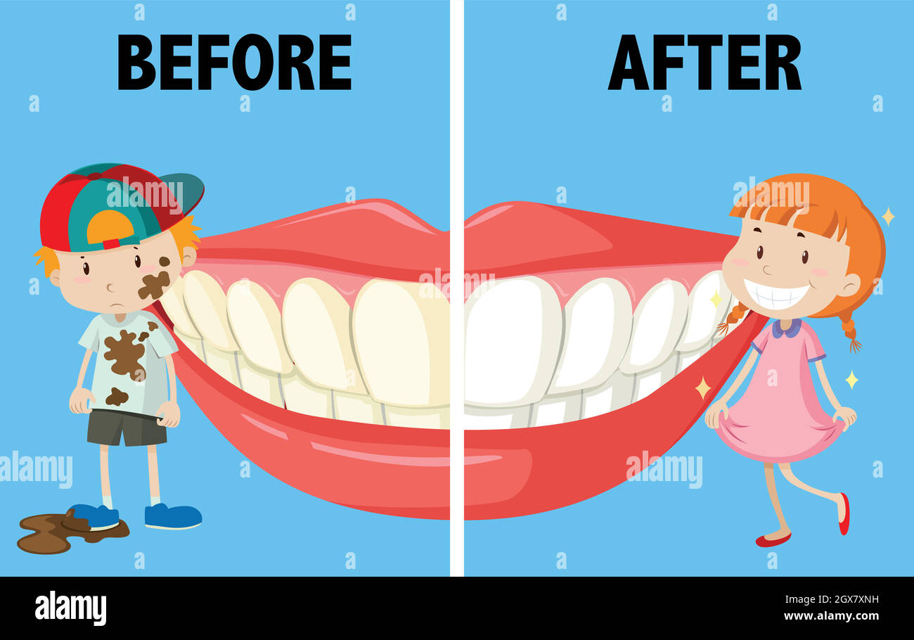 Before And After Words