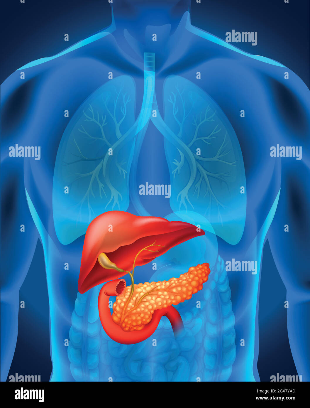 Pancreas cancer in human body Stock Vector Image & Art - Alamy