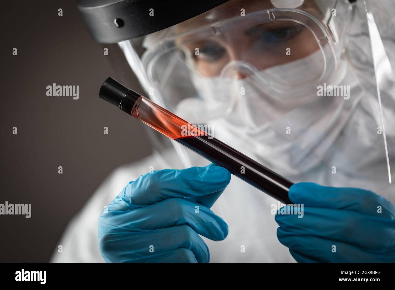 Female Lab Worker Holds Test Tube of Blood For Testing Stock Photo - Alamy