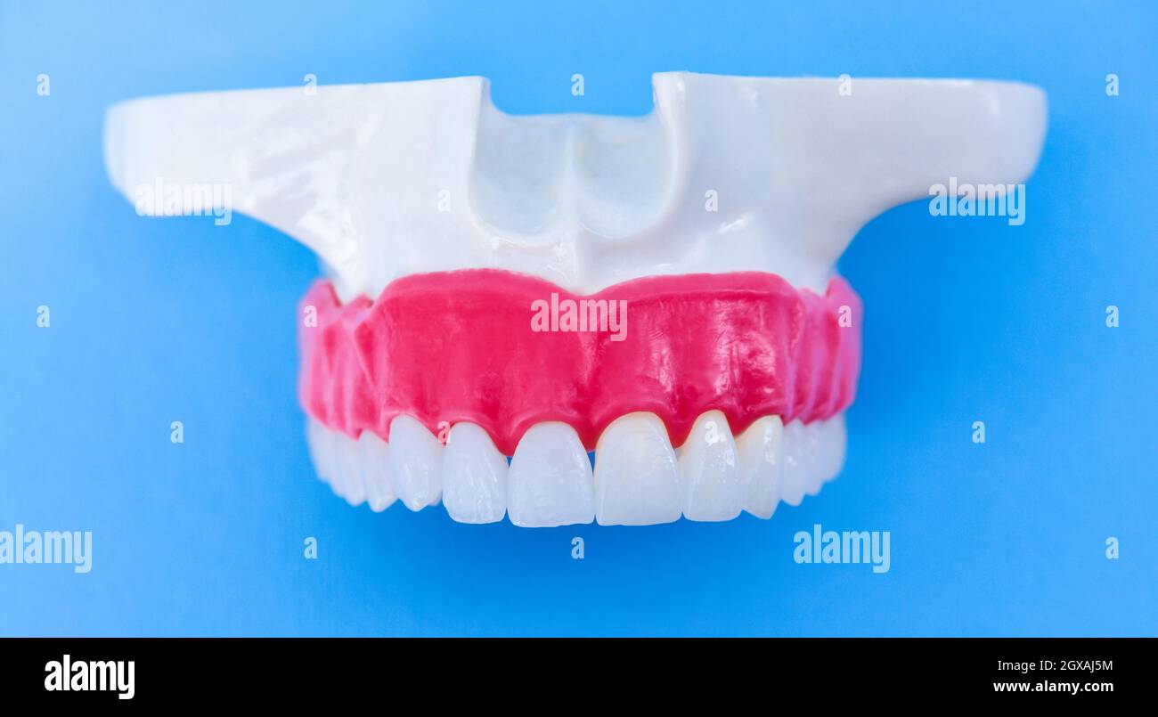 Upper human jaw with teeth and gums anatomy model medical illustration ...