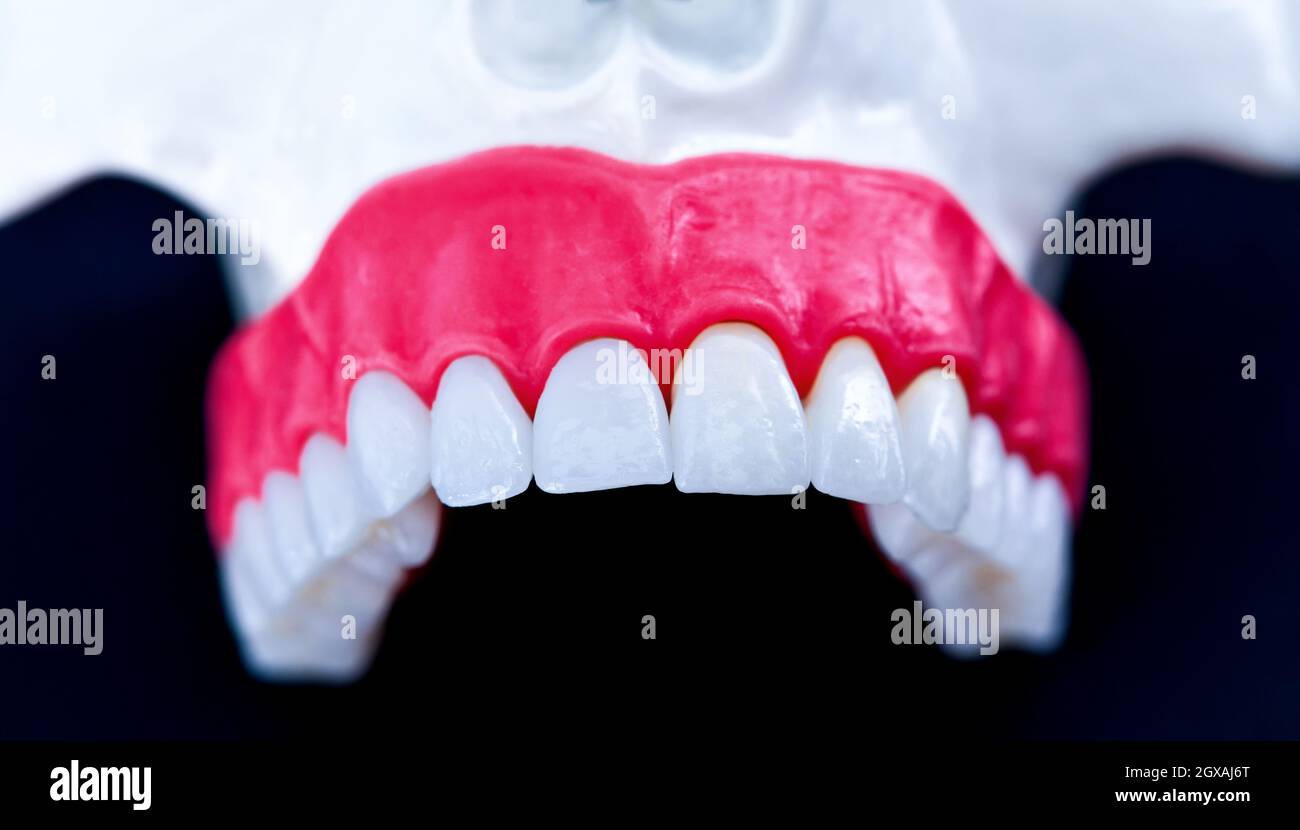 Upper human jaw with teeth and gums anatomy model medical illustration ...