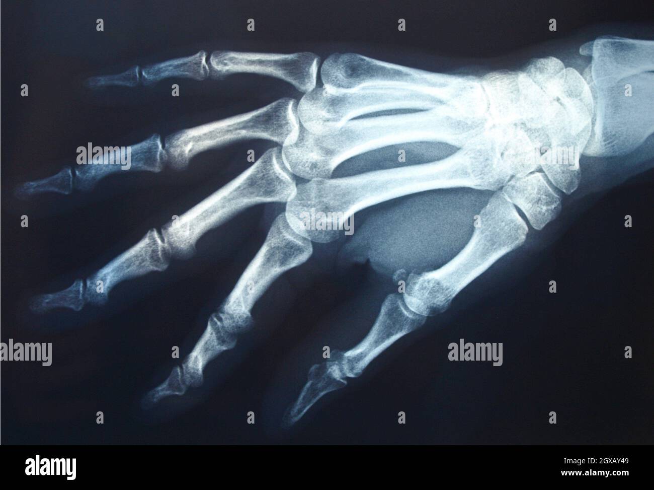 Radiology diagnostic hi-res stock photography and images - Alamy