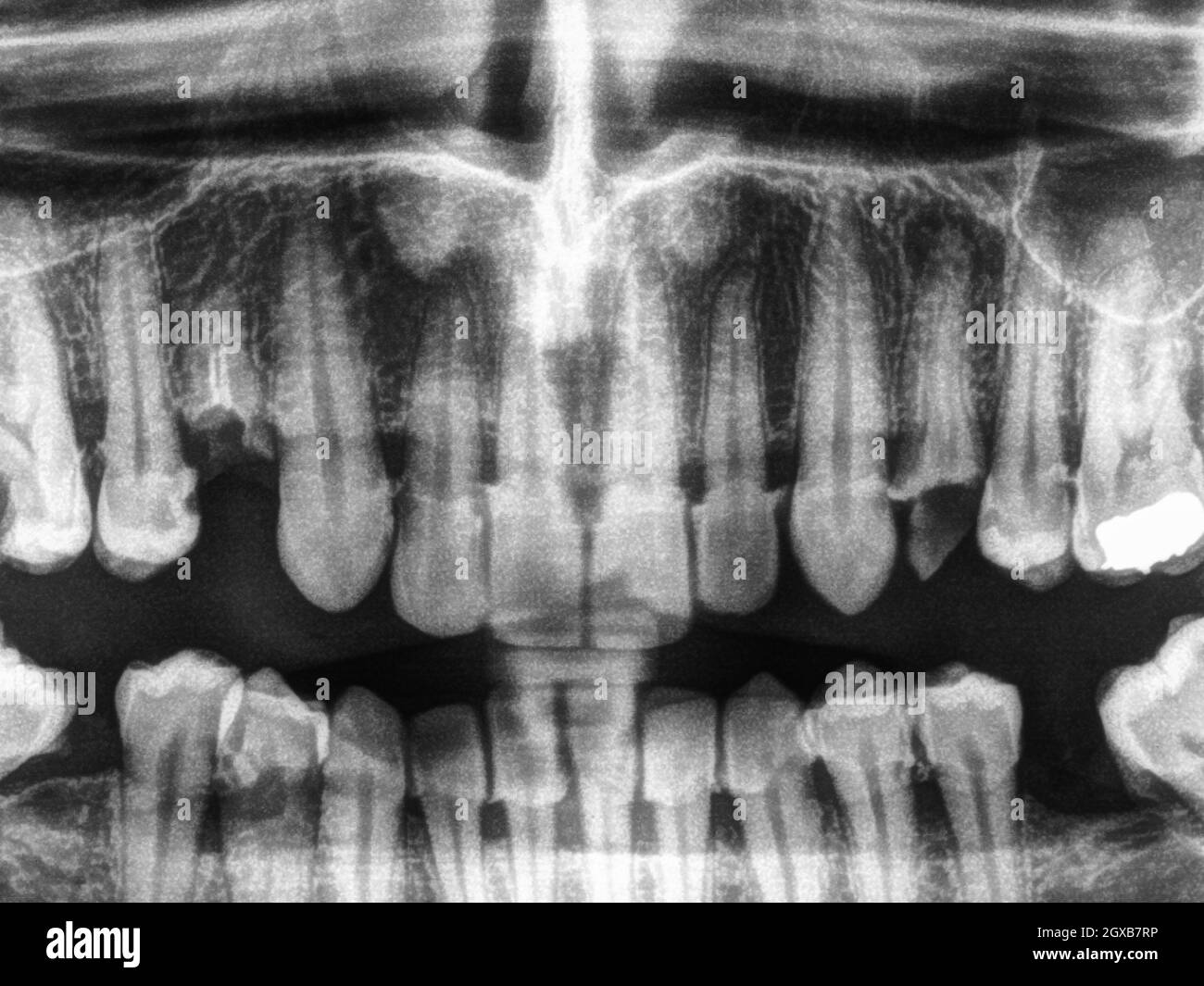 The human body black and white hi-res stock photography and images - Alamy