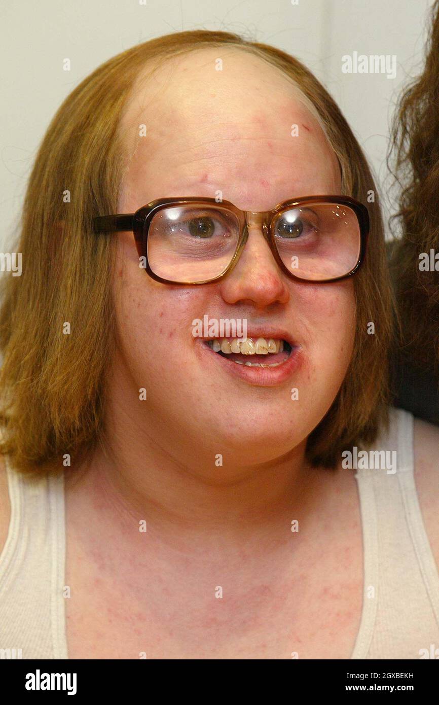 Matt Lucas With Hair