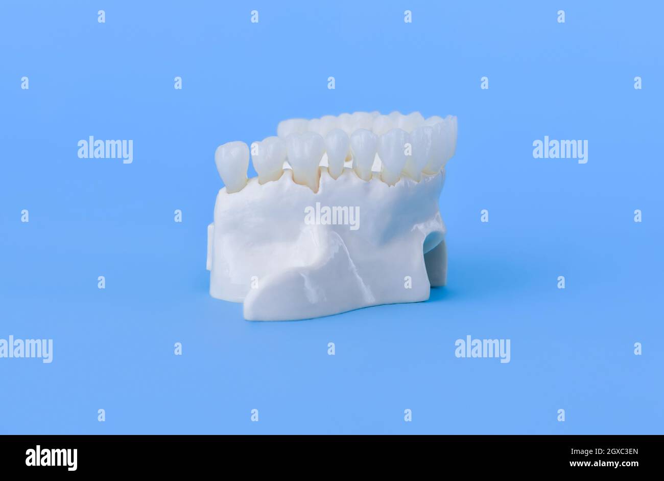 Upper human jaw with teeth anatomy model medical illustration isolated ...