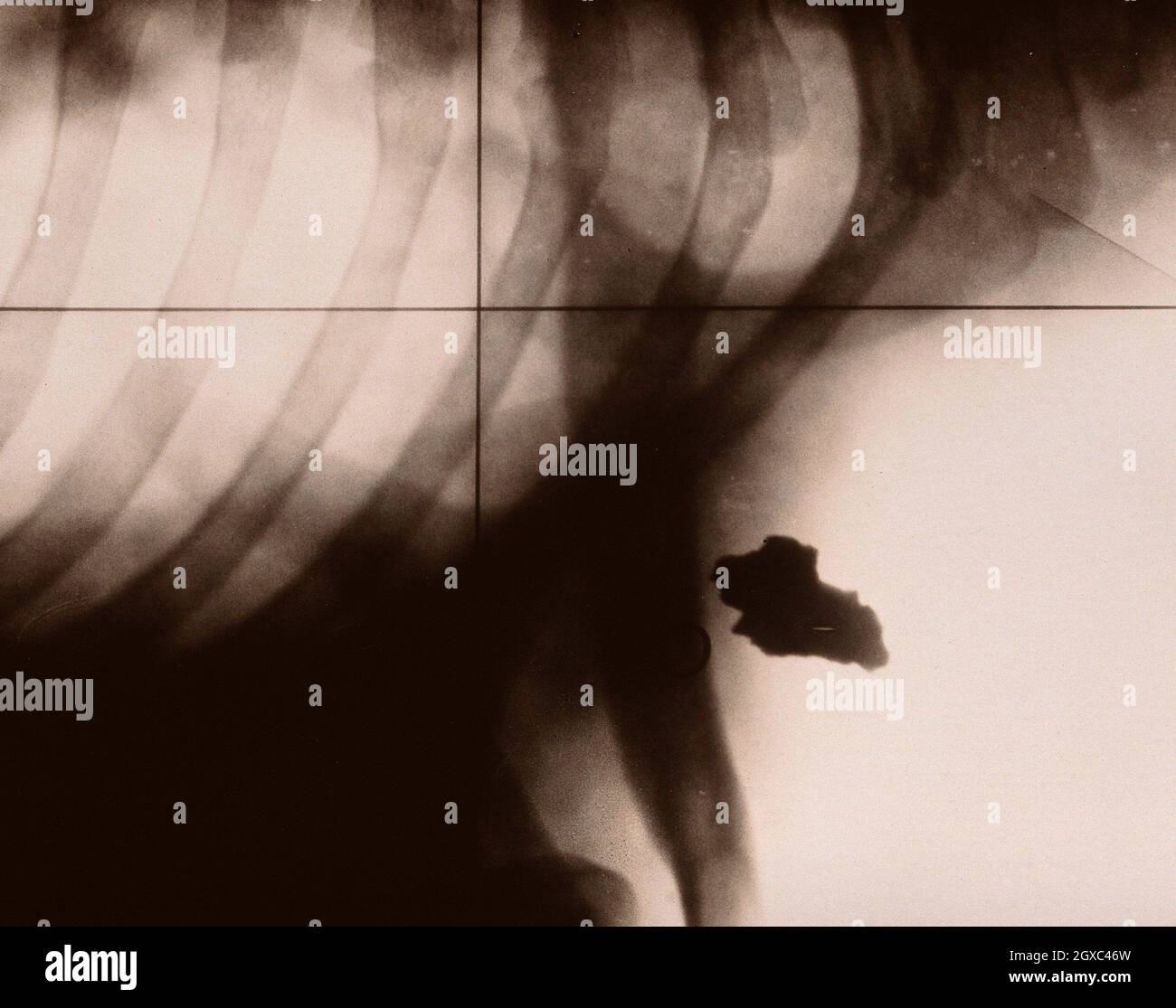 X ray image showing rib cage hi-res stock photography and images - Alamy
