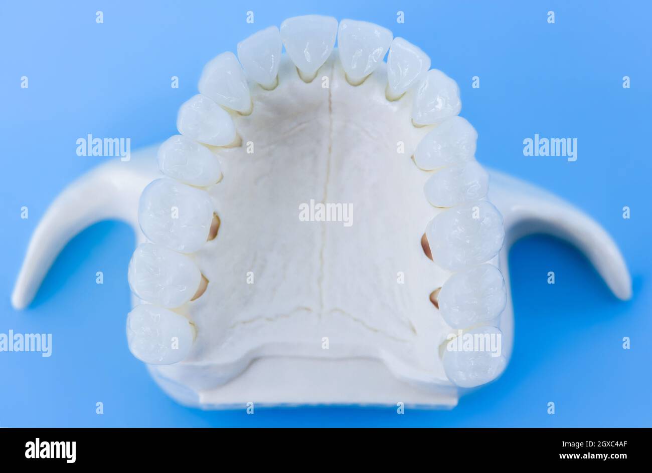 Upper human jaw with teeth anatomy model medical illustration isolated ...