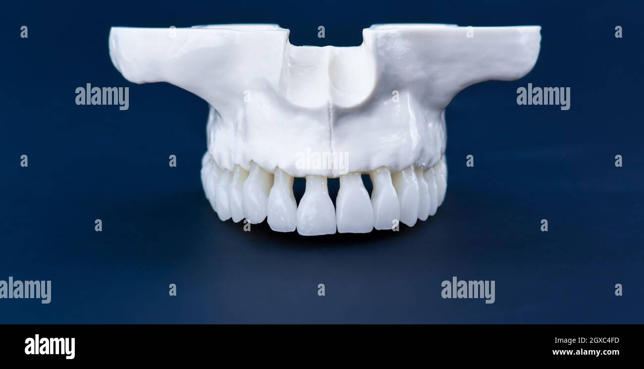 Upper human jaw with teeth anatomy model medical illustration isolated ...