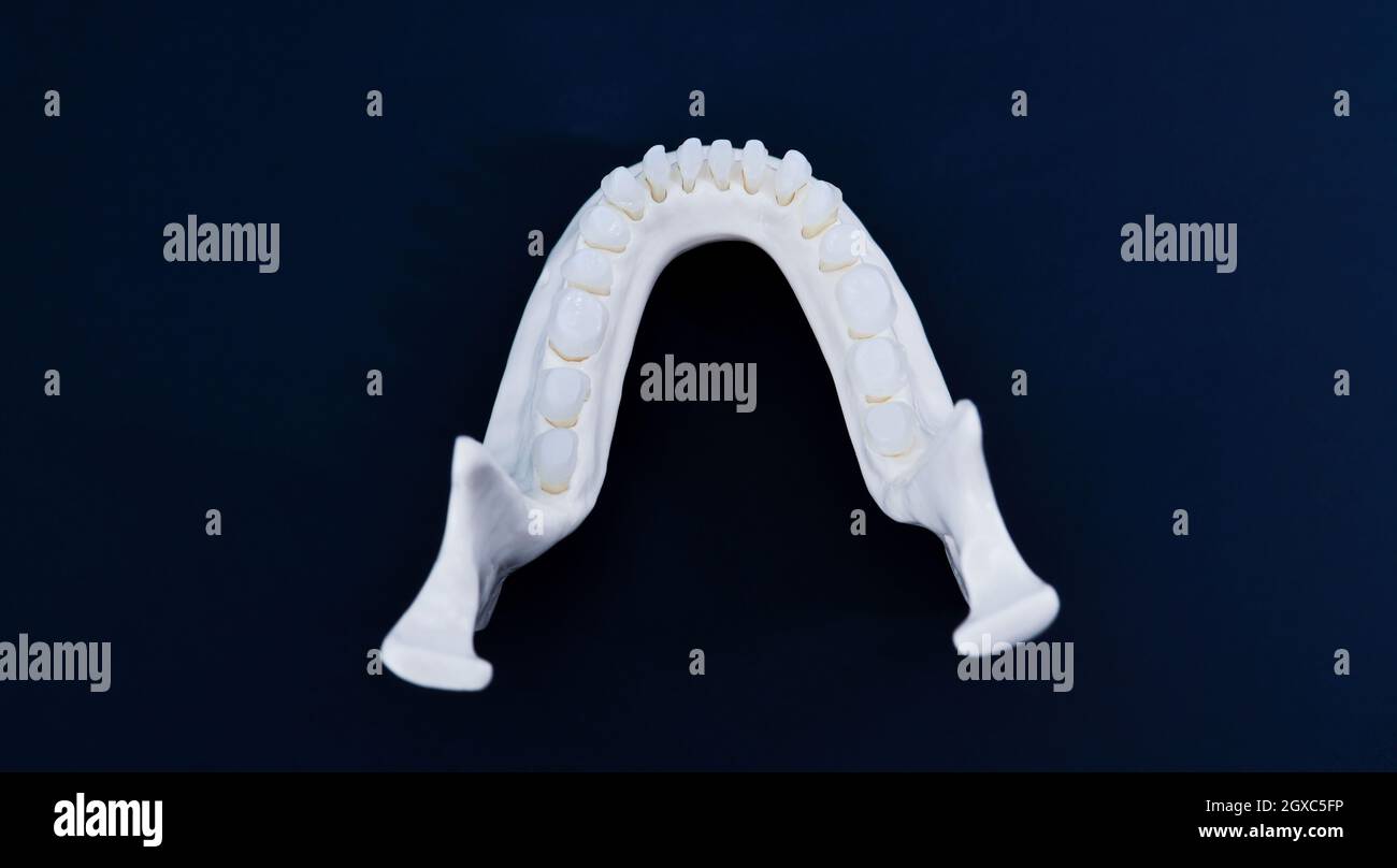 Lower human jaw with teeth anatomy model medical illustration isolated ...