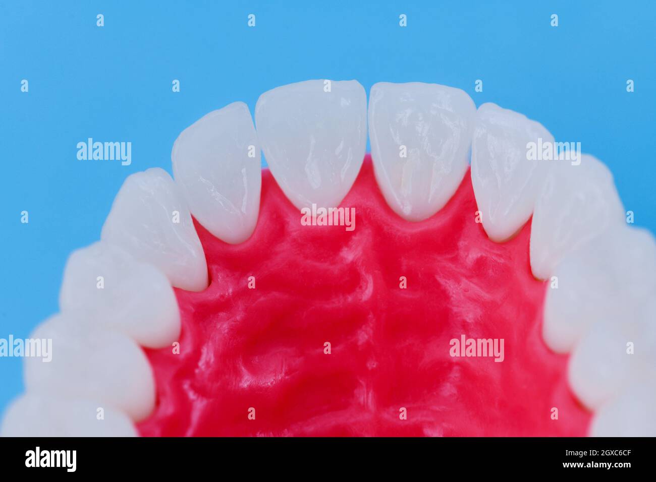 Upper human jaw with teeth and gums anatomy model medical illustration ...