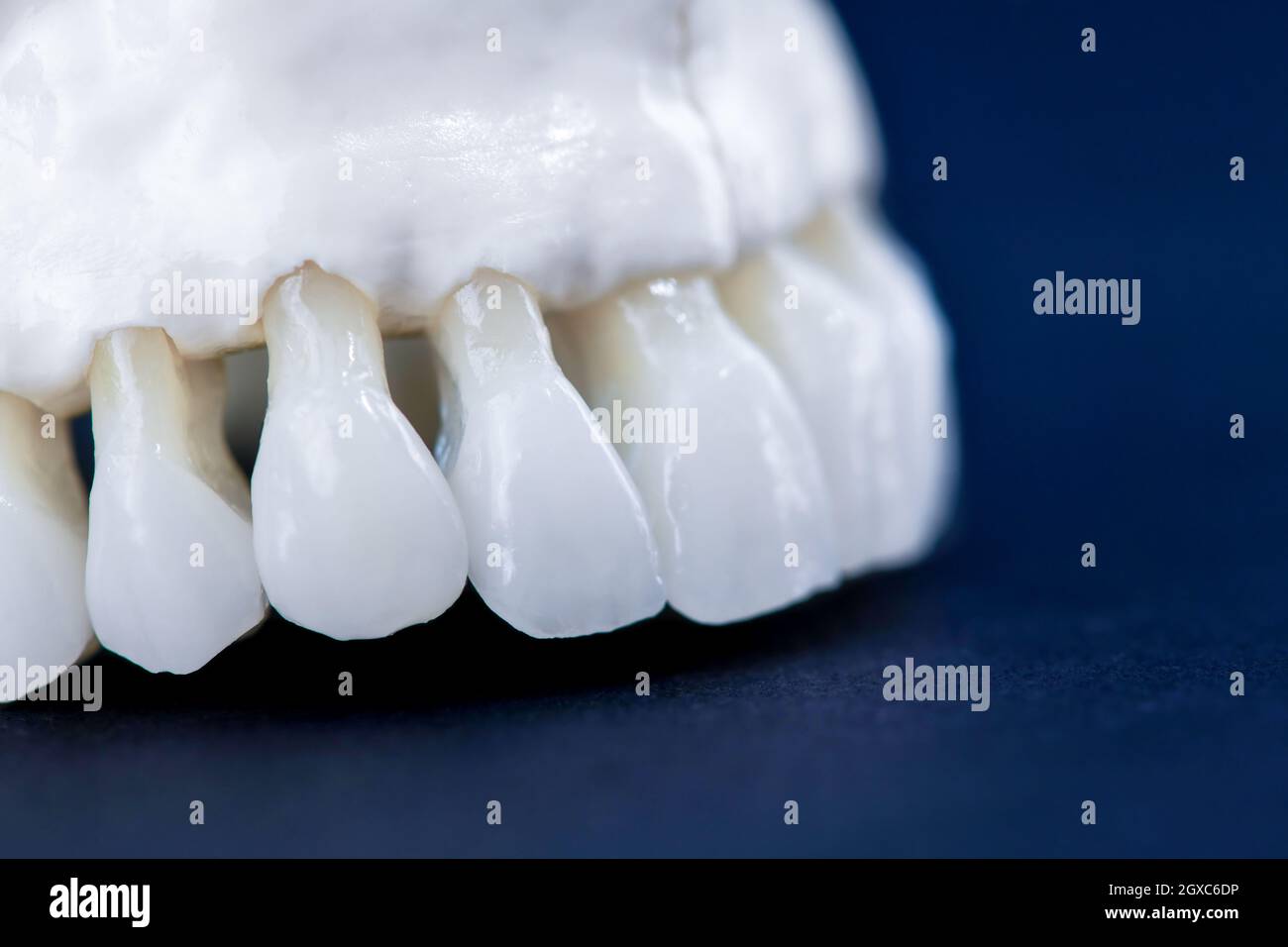 Upper human jaw with teeth anatomy model medical illustration isolated ...