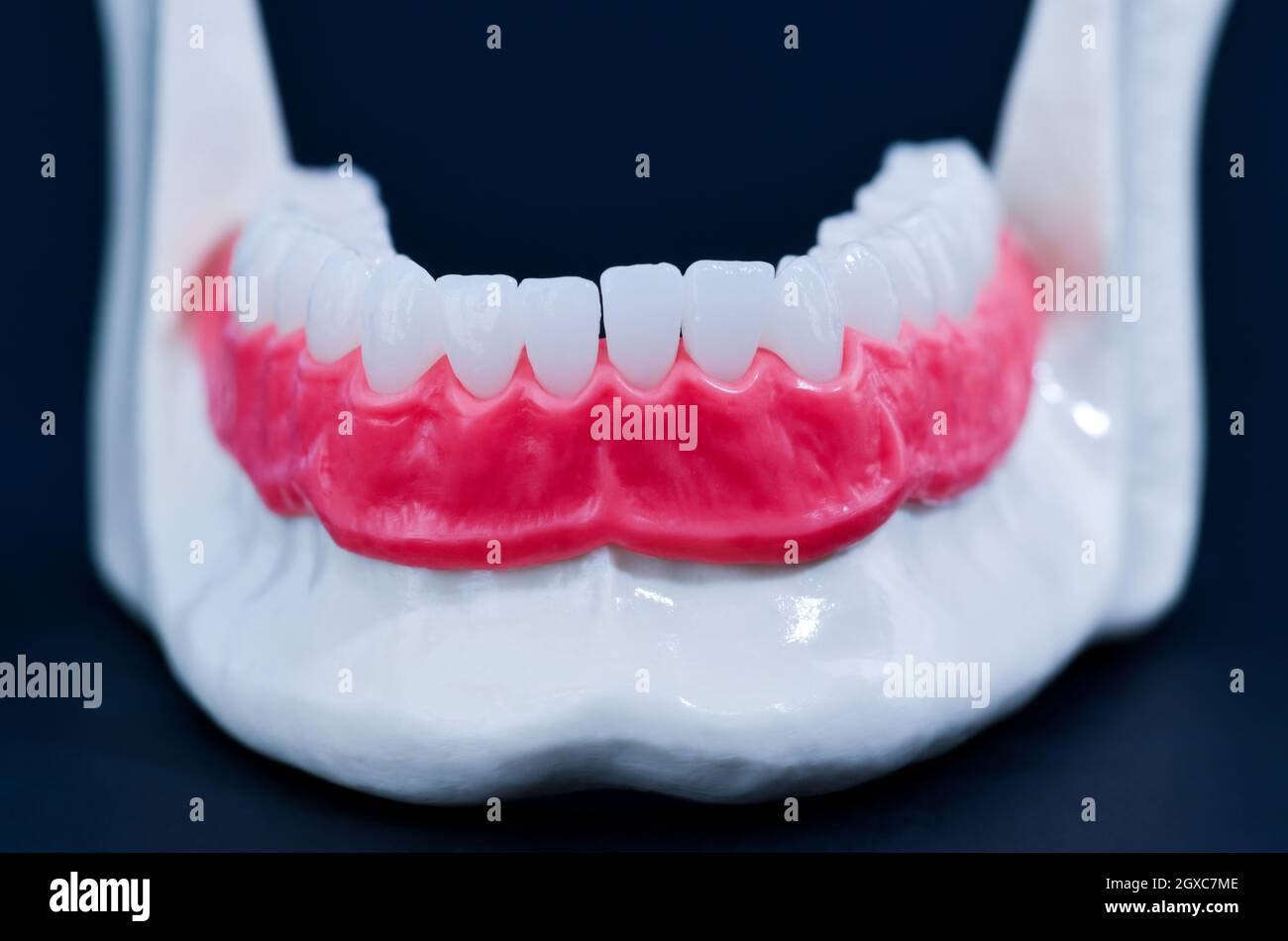 Lower human jaw with teeth and gums anatomy model medical illustration ...