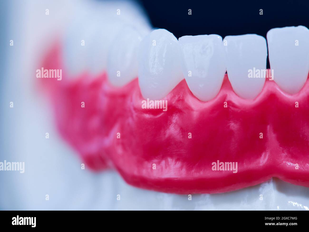 Lower human jaw with teeth and gums anatomy model medical illustration ...