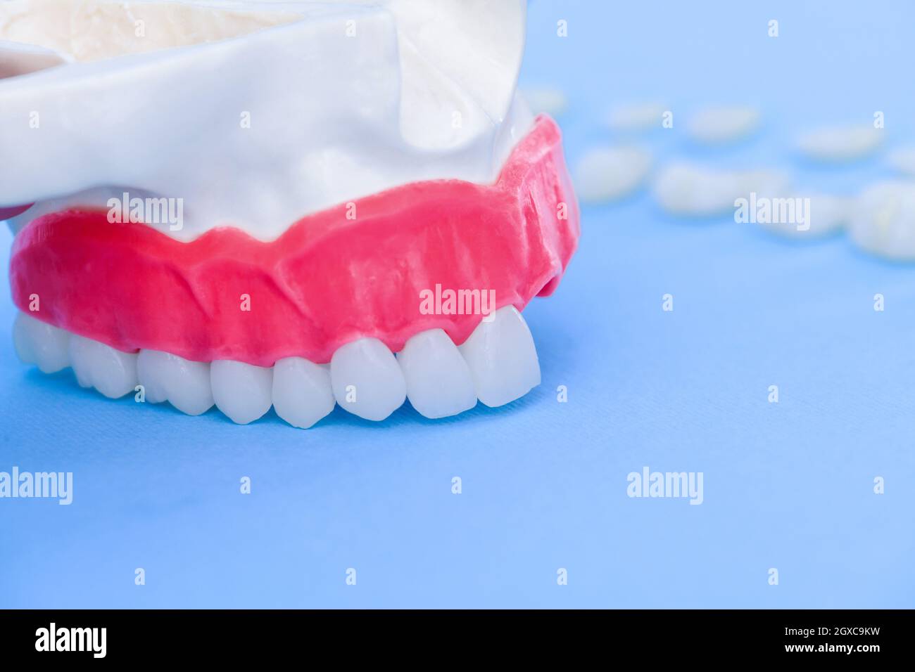 Teeth implant and crown installation process isolated on a blue ...