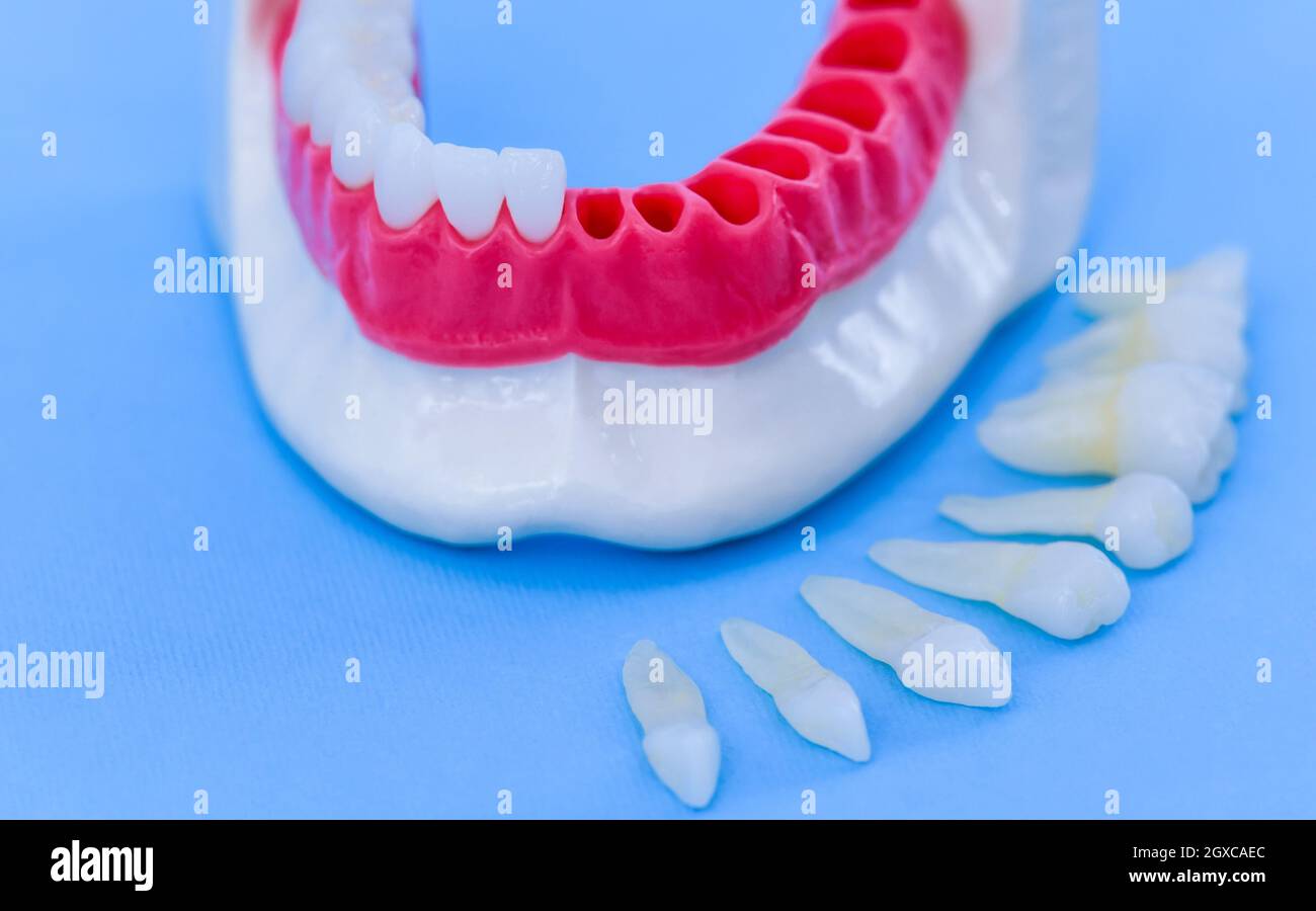 Teeth implant and crown installation process isolated on a blue ...