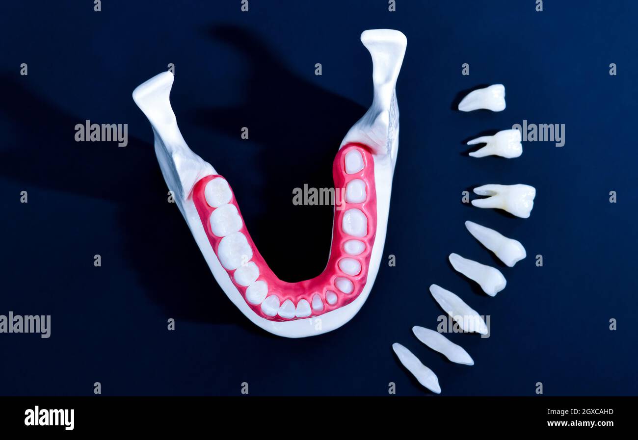 Teeth implant and crown installation process isolated on a blue ...