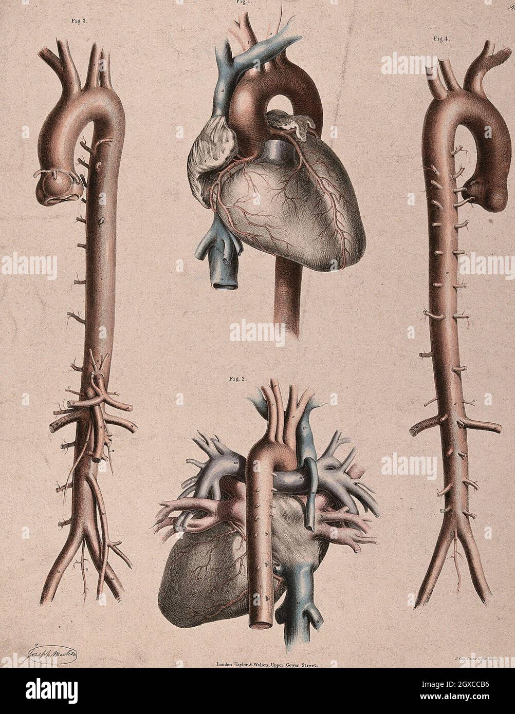 Dissection Showing High Resolution Stock Photography and Images - Alamy