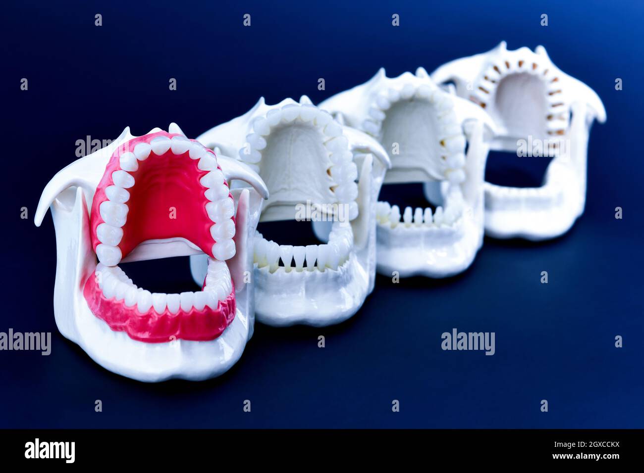 Dentist orthodontic teeth models with jaws opened on blue background ...