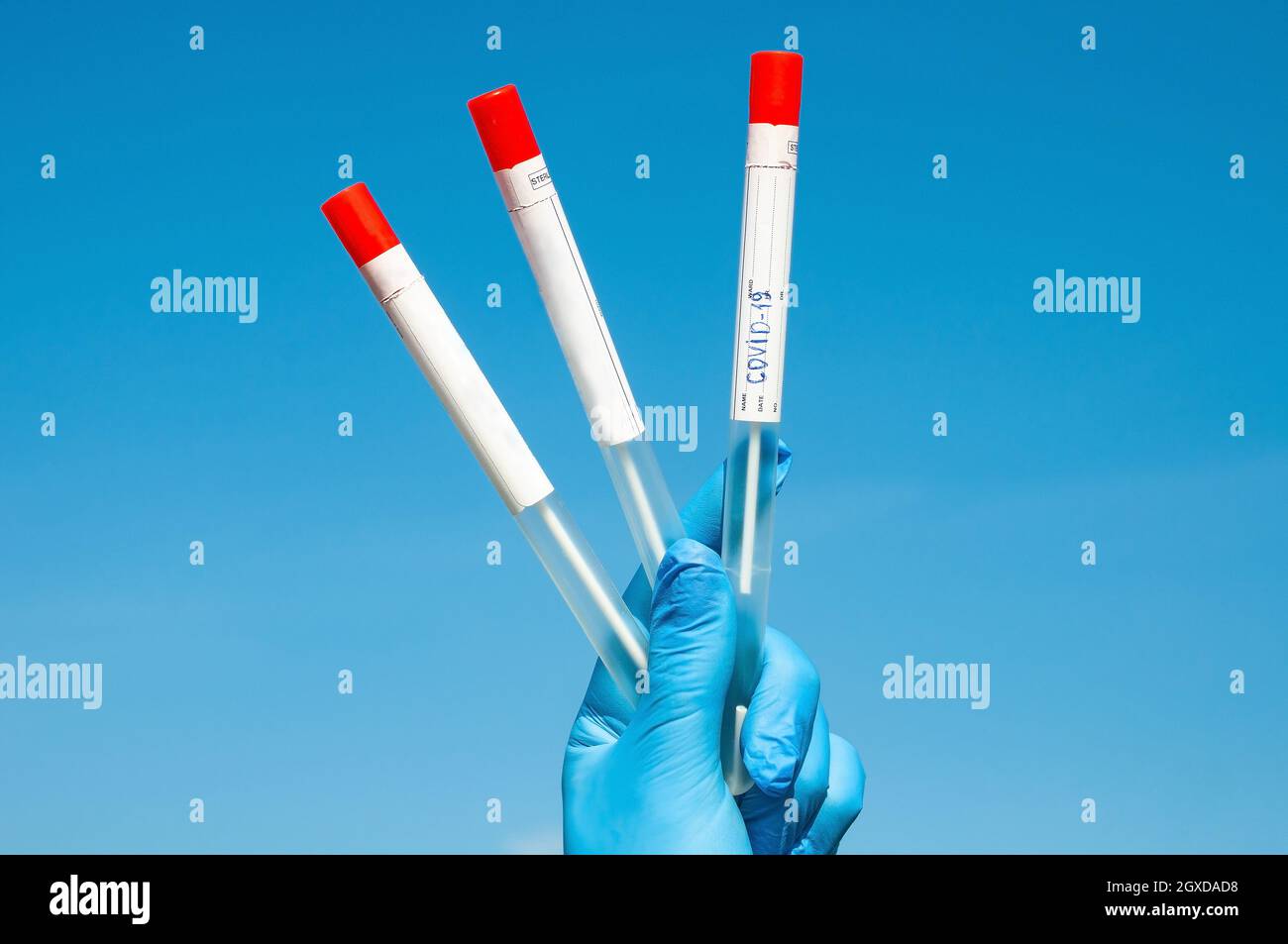 Biochemical tests bacteria hi-res stock photography and images - Alamy