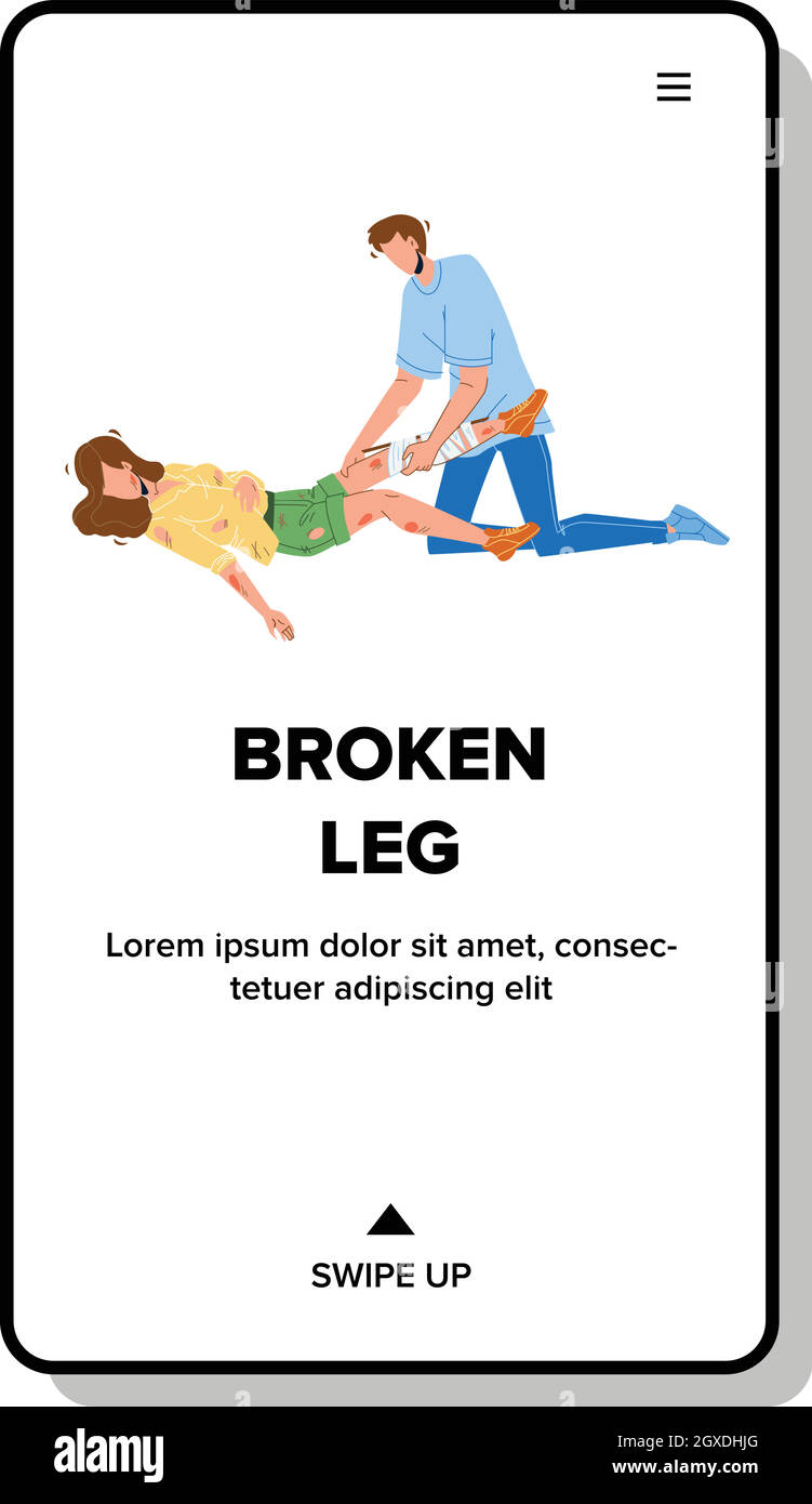 Cartoon girl patient broken leg hi-res stock photography and images - Alamy