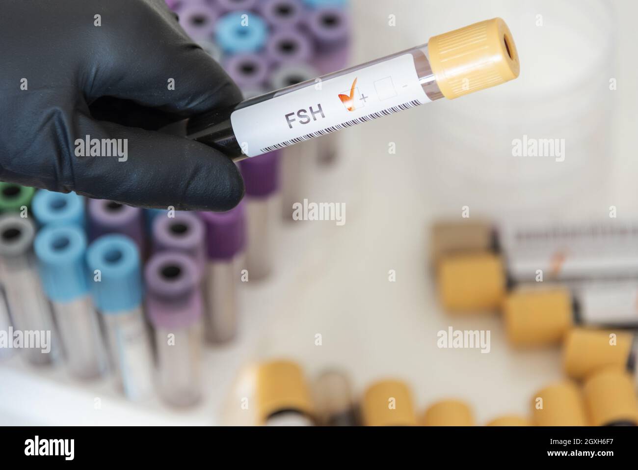 Blood test sample from hi-res stock photography and images - Alamy